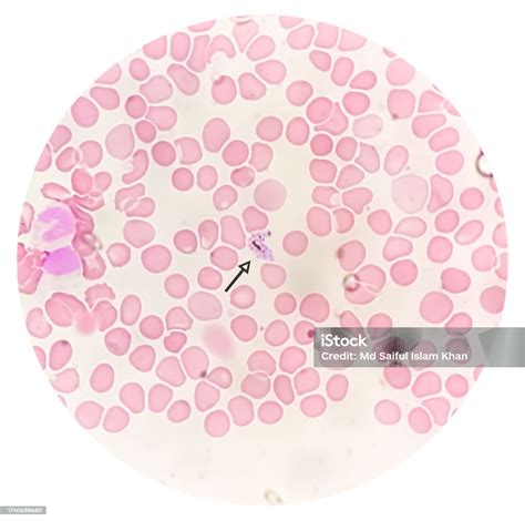 Plasmodium Vivax In Thin Film Under Microscopy Malaria Disease P Vivax