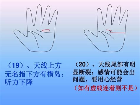 最全手诊图谱，一看就懂（非常实用）网络