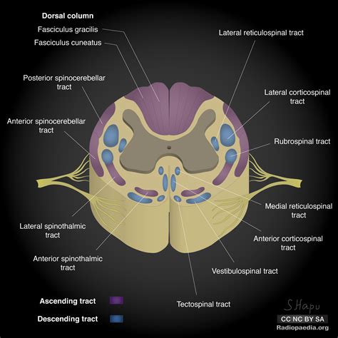 Radiopaedia Drawing Tracts Of The Spinal Cord From Anterior English