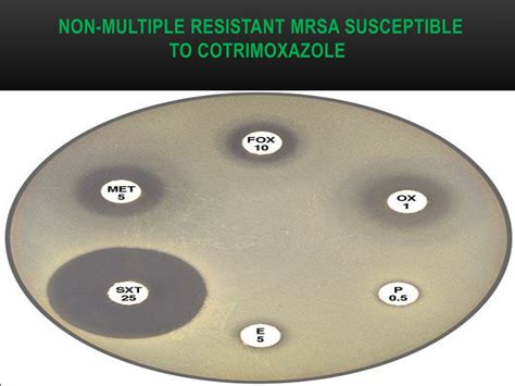 Ppt Community Associated Mrsa Ca Mrsa Powerpoint Presentation Free Download Id 195380