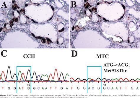 Figure 2 From Absence Of Ret Gene Point Mutations In Sporadic Thyroid C
