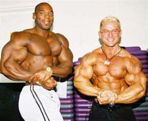 Here Are A Bunch Of Pictures Of People That Have Injected Synthol Into