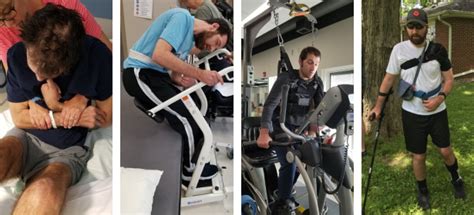 Physical Medicine And Rehabilitation Treating Spasticity