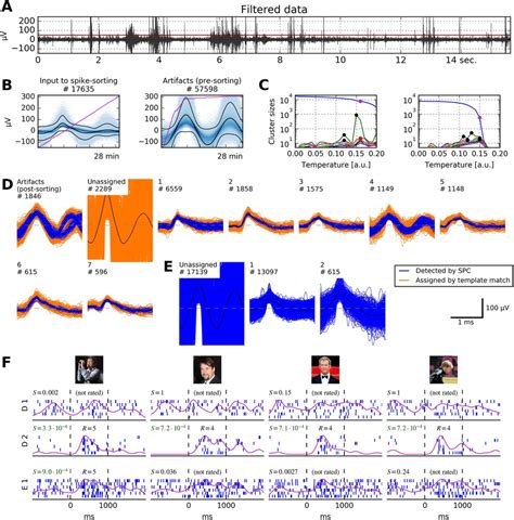 Our Algorithm Applied To Recordings From The Human Medial Temporal Lobe Download Scientific