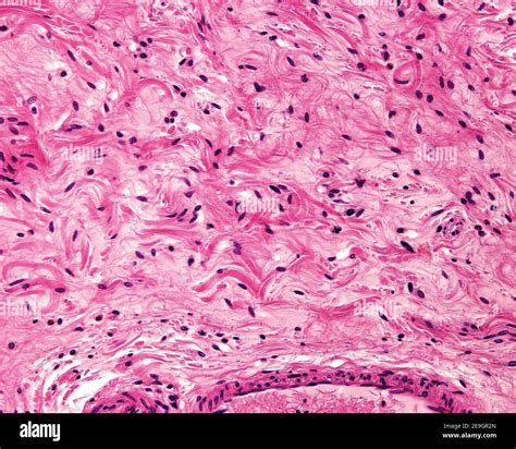 Dense Irregular Tissue Under Microscope