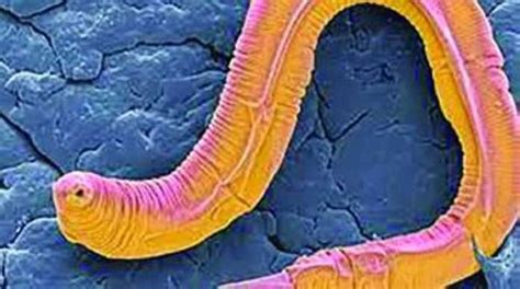 Lung Cancer Detecting Worms Kuwait Local News