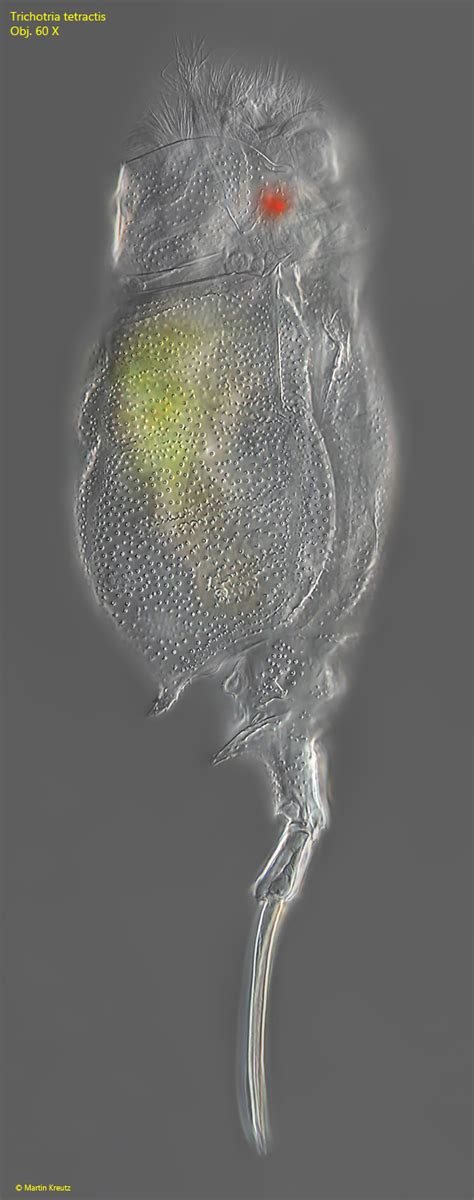 Trichotria Tetractis Real Micro Life