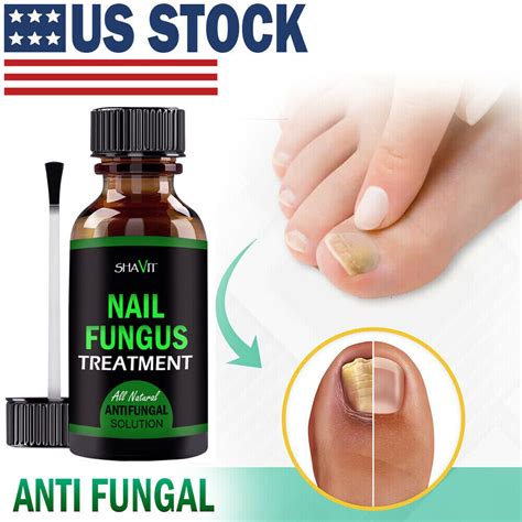 Anti Fungal Treatment Extra Strength Toenail Fungus Athletes Foot Fung
