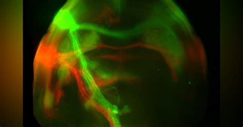 Optogenetic Stimulation Could Eliminate Sweet Cravings In Brains
