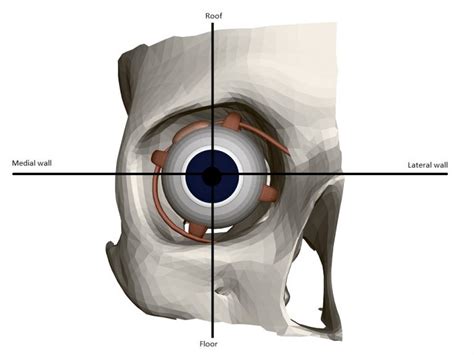 Code Orbital Fractures With Improved Clarity In AAPC Knowledge Center
