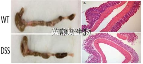 Dss诱导小鼠肠炎模型 南京英瀚斯生物科技有限公司