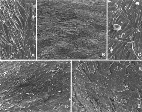 Oa Replicated Crossed Lamellar Microstructure Specimen Smnh Mo160431 Download Scientific