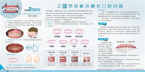 口腔正畸 牙科知识科普设计图psd分层素材psd分层素材设计图库昵图网
