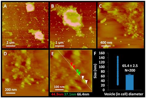 Atomic Force Microscopy Afm Of Intact And Lysed Human Platelets Download Scientific Diagram