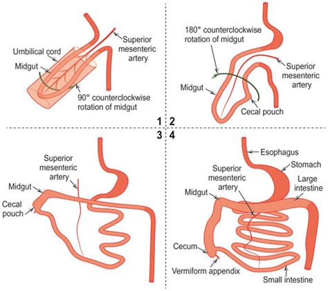 The Vermiform Appendix And Its Pathologies