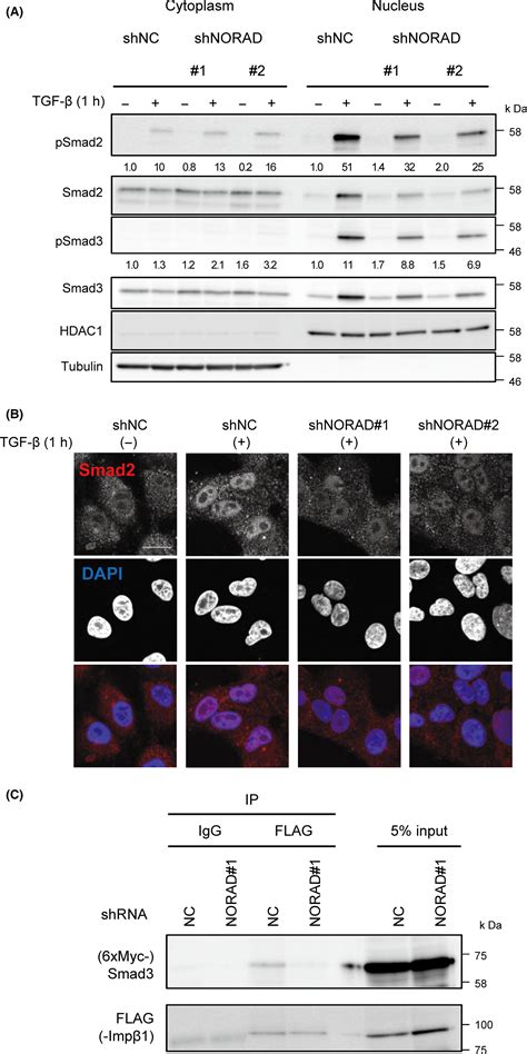 Long Noncoding Rna Norad Regulates Transforming Growth Factor‐β Signaling And Epithelial‐to