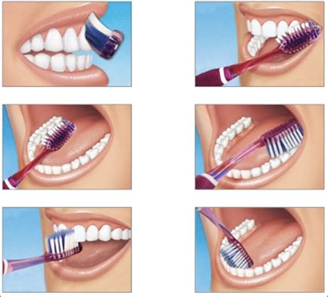Técnica De Cepillado Con Cuidado Puedes Gozar De Una Dentadura Sana
