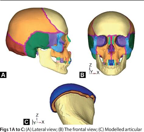Figure 1 From A 3d Finite Element Analysis Of Stress On