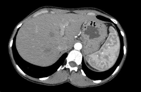 Python Medical Image Quality Problem With Dicom Files Stack Overflow