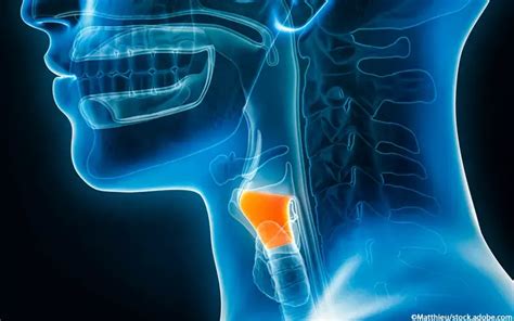 Laryngitis Symptome Diagnostik Therapie Gelbe Liste