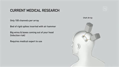 Neuralink Progress Update Summer 2020 Summary R Neuralink