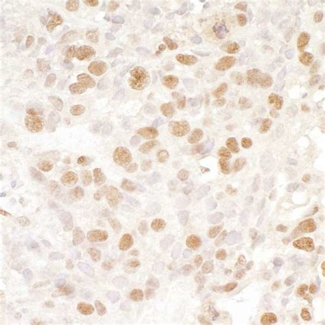 Brd4 Polyclonal Antibody Ihc 00396