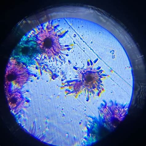 What Does A Virus Look Like Under A Microscope A Visual Guide