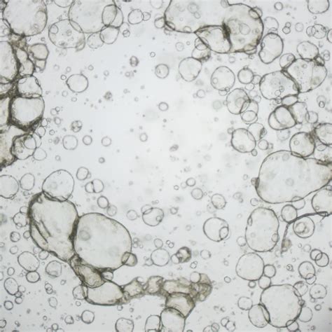 Cholangiocarcinoma Organoid Lambda Biologics