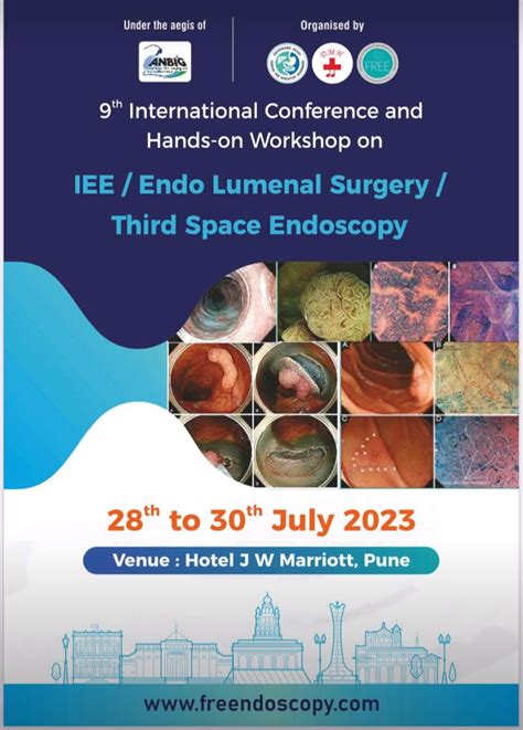 Ashutosh Shinde Posted On Linkedin