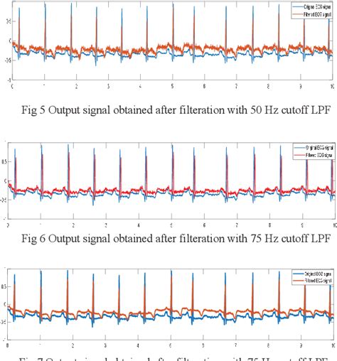 Figure 6 From Ecg Signal Denoising Using Sparrow Search Algorithm Semantic Scholar