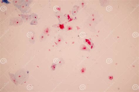 显微镜下组织样品鳞状上皮细胞 库存图片 图片 包括有 电池 教育 封垫 健康 背包 详细资料 222889513