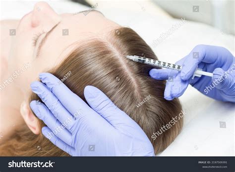 Woman Receiving Injection Into Scalp Beauty Stock Photo Shutterstock