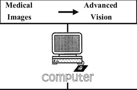 Computer Aided Surgery Download Scientific Diagram