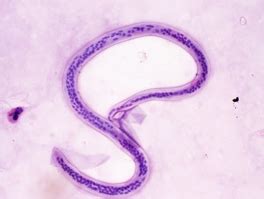 Parasitology Week 6 Flashcards Quizlet