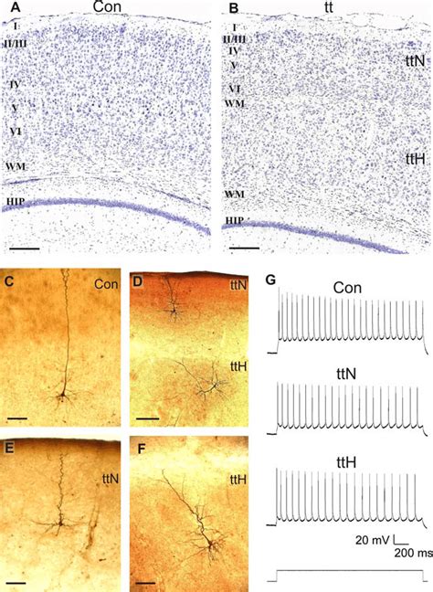 Cellular Morphology And Action Potentials Of Pyramidal Cells In The Download Scientific Diagram