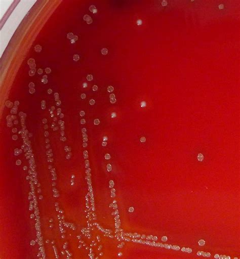 Z Mikrobiologią Za Pan Brat Streptococcus Pyogenes