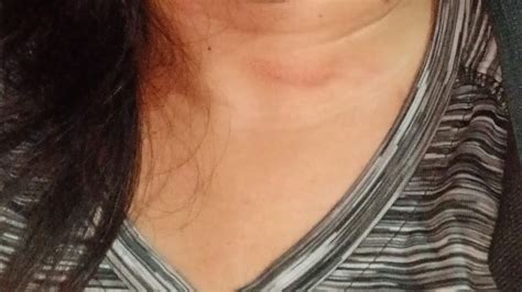 Orbelina Caleb Est En Vivo Con Dilbert Youtube