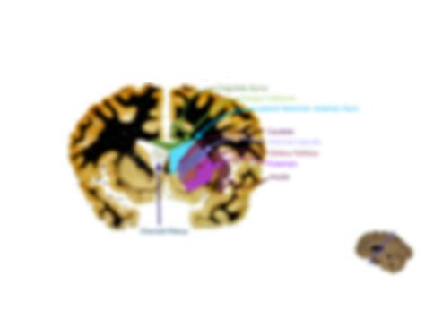 Solution Anatomy 338 Lab Neuro Cerebrum Cross Sections Labeled With