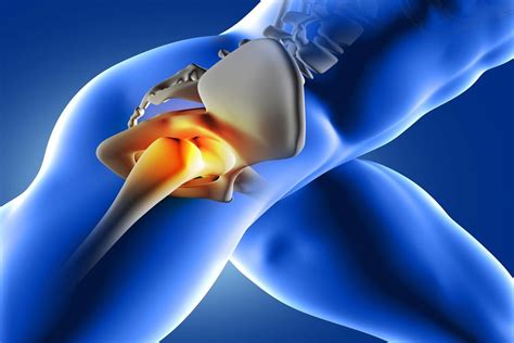 Labral Tear Hip Surgery Recovery And Pt Support Sustain Pt