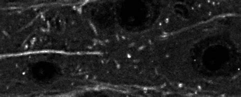 Super Resolution Imaging Of Myelin In Mouse Brain Using A Multiphoton Confocal Microscope
