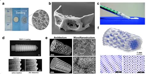 Calcium Phosphate Based Applications A Wh Incorporated Hydrogel