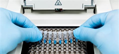 Fluorometer Principles Types Applications And Advances In