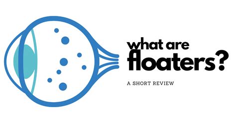 What Are Eye Floaters