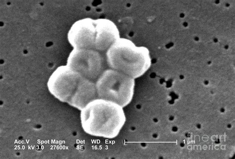 Acinetobacter Baumannii Sem 6 Photograph By Science Source Fine Art