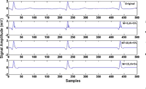 Figure 8 From Compressed Sensing System Considerations For Ecg And Emg