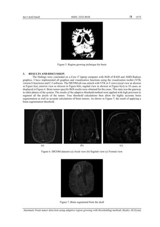 Automatic Brain Tumor Detection Using Adaptive Region Growing With Thresholding Methods PDF