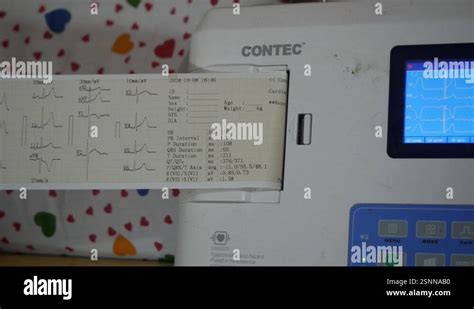Ecg Machine Display And Print Out Chart Indicating Hearts Electrical