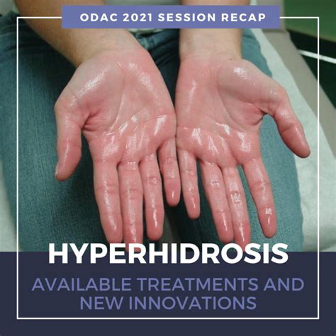 Primary Hyperhidrosis Archives Next Steps In Dermatology