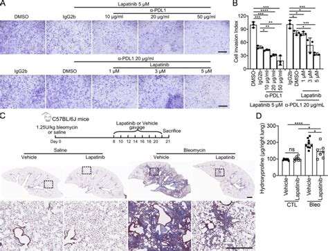 Targeting Her2 Blunted Bleomycin Induced Murine Lung Fibrosis A And Download Scientific