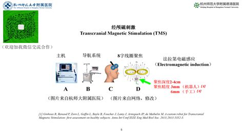 【学术报告整理】功能磁共振对异常脑活动精准定位并引导精准定位tms治疗 脑医汇
